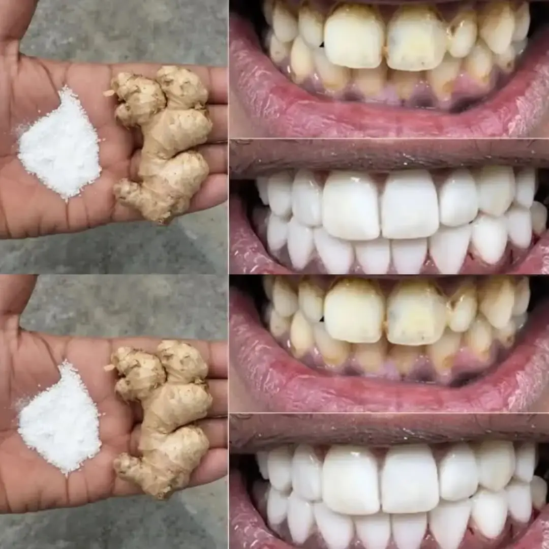 Whiten Your Teeth in Just 2 Minutes – Powerful Home Remedy with Ginger ...