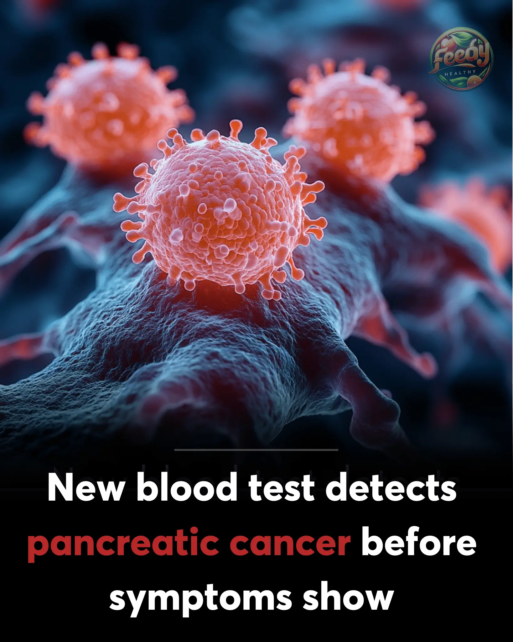 New blood test identifies hard-to-detect pancreatic cancer with 85% ...