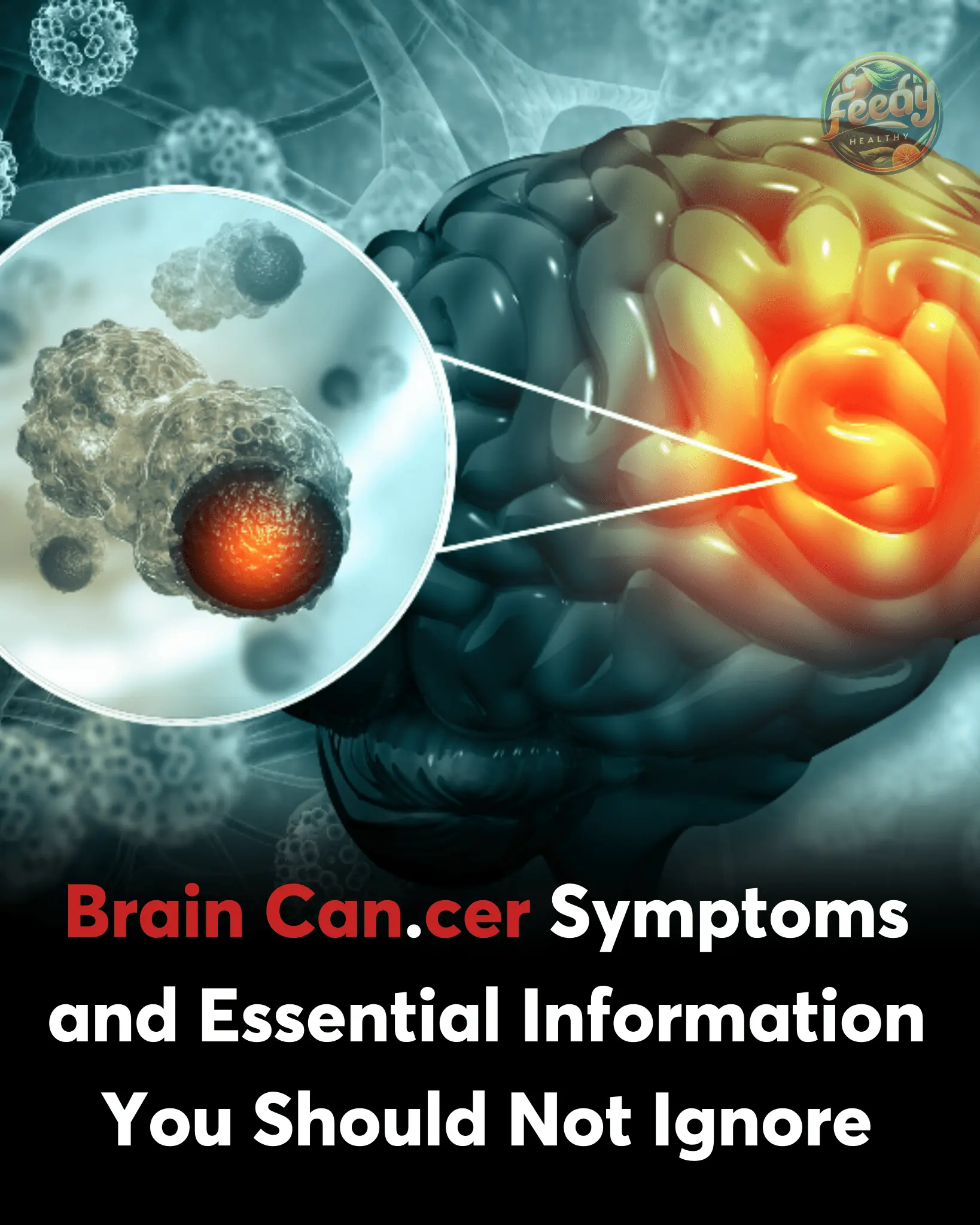 Brain Cancer Symptoms and Essential Information You Should Not Ignore