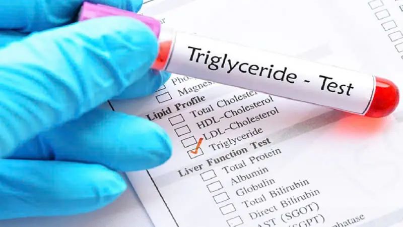 "Triglyceride Giant" Detected: A Reminder for Those Over 55 – Foods to ...