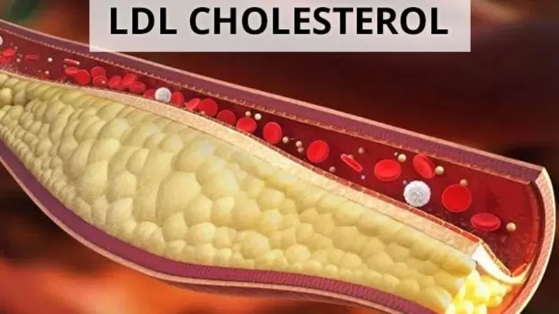 High LDL? This Could Be a Good Sign! A Doctor Will Give You the ...