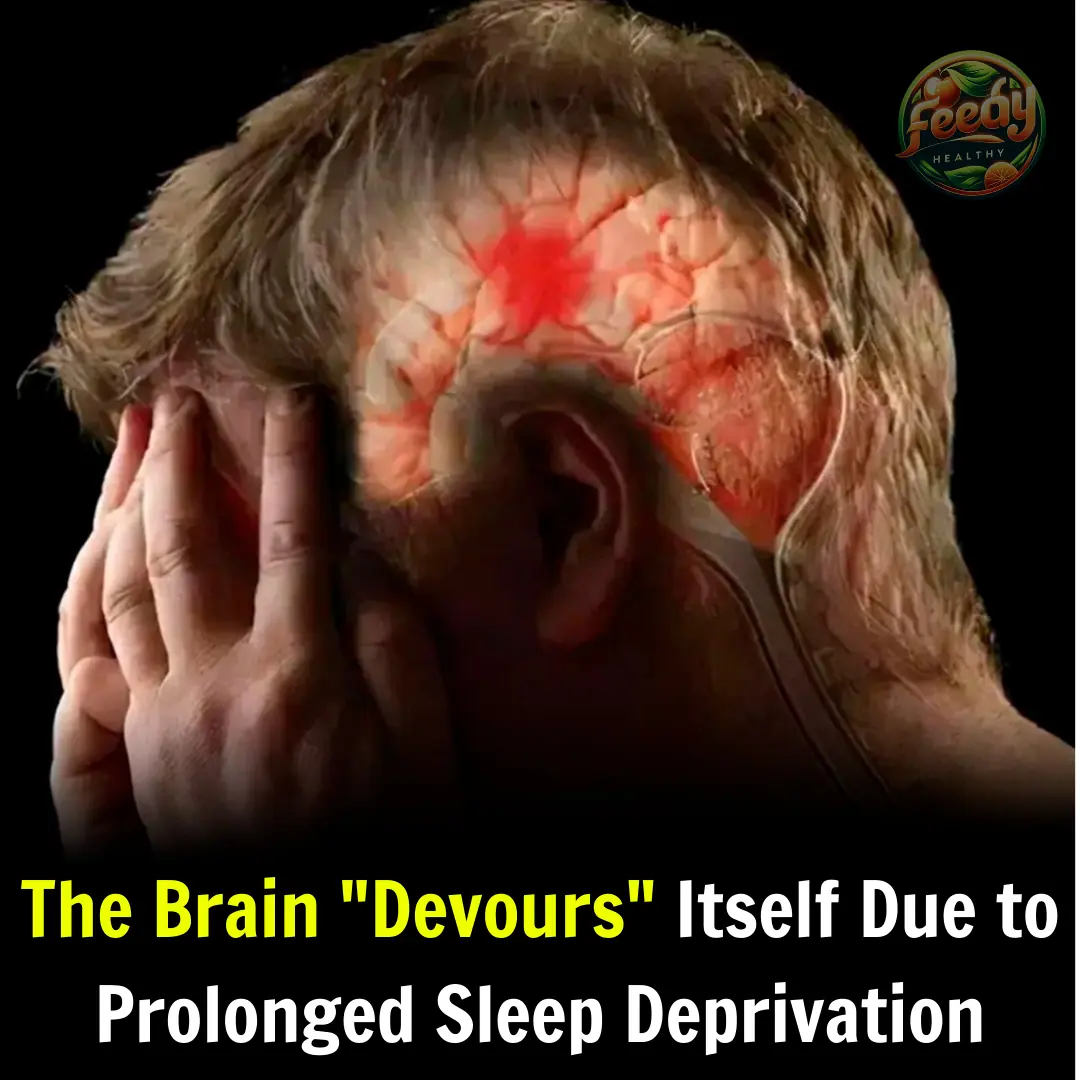 The Brain "Devours" Itself Due to Prolonged Sleep Deprivation