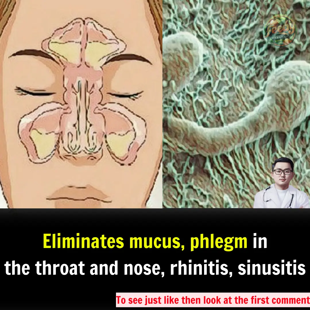 4 Effective Home Remedies to Eliminate Mucus and Phlegm in the Throat, Sinusitis, and Rhinitis