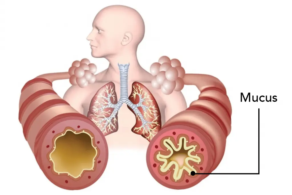 How To Get Rid Of Phlegm And Mucus In Your Throat And Chest On Your Own