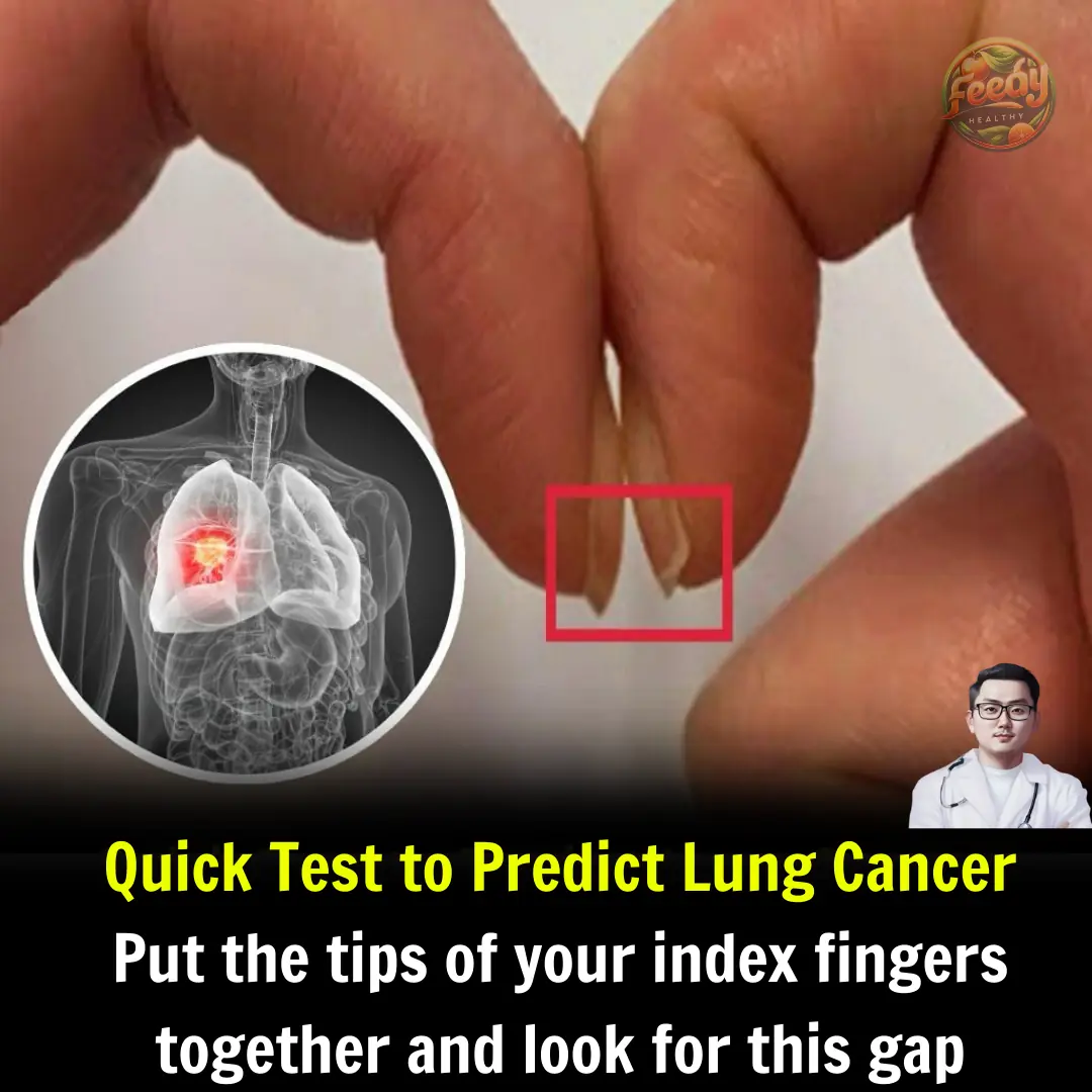 Quick Test to Predict Lung Cancer Put the tips of your index fingers ...