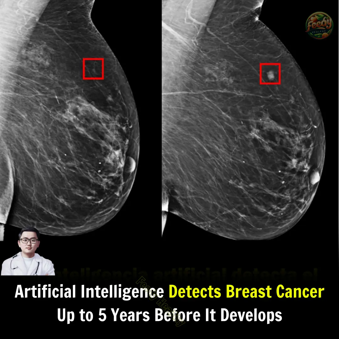 Artificial Intelligence Detects Breast Cancer Up to 5 Years Before It ...