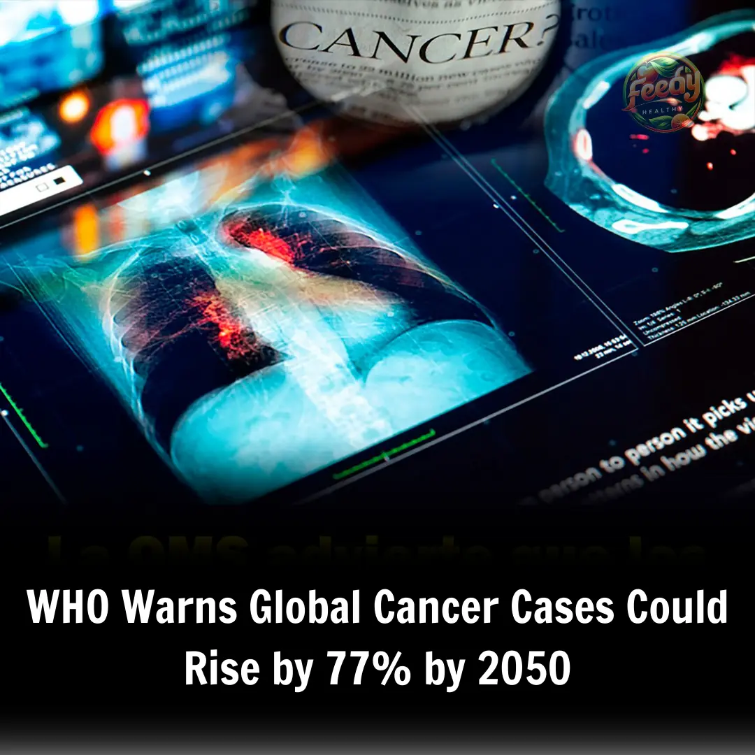 WHO Warns Global Cancer Cases Could Rise by 77% by 2050