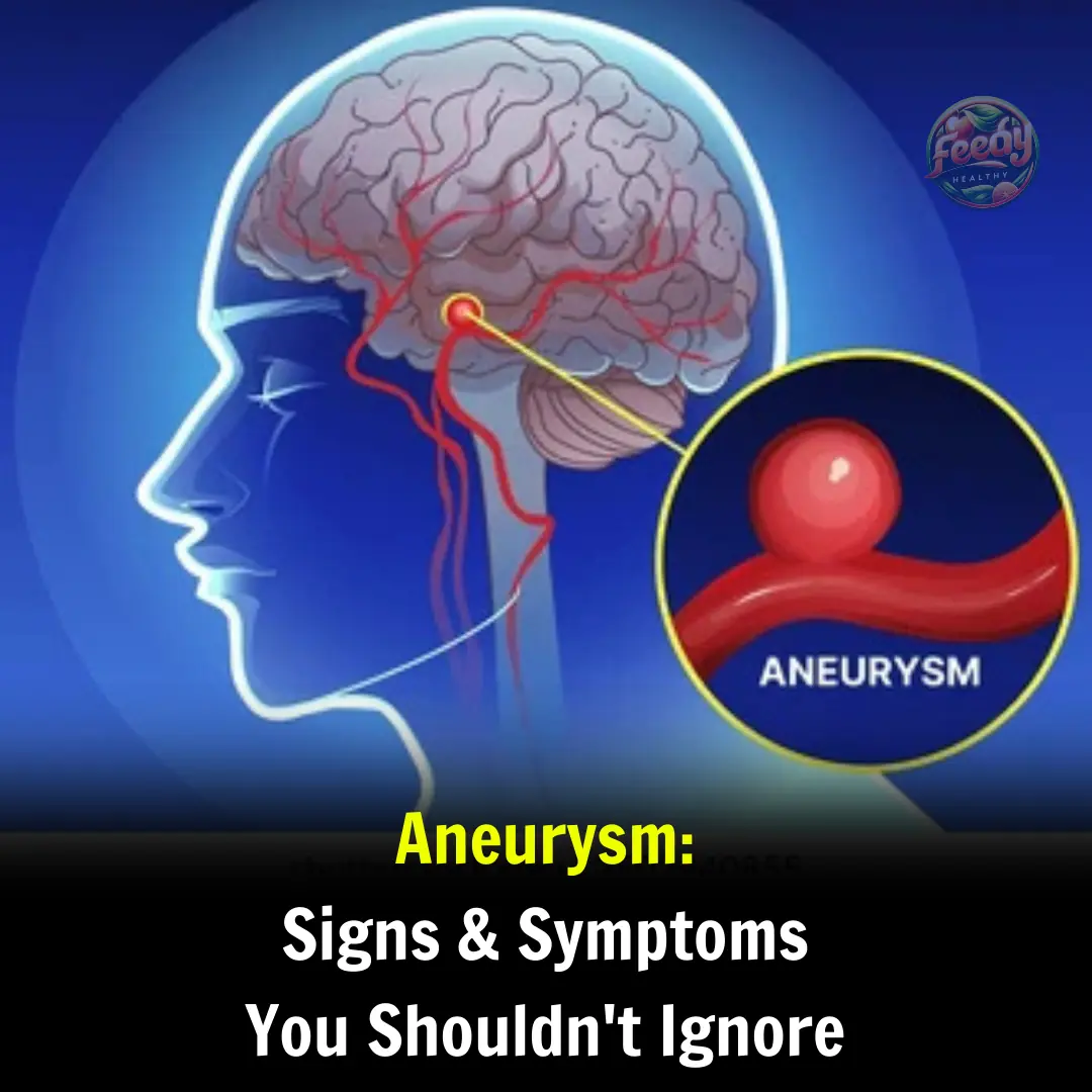 12 Early Warning Signs of an Aneurysm You Shouldn’t Ignore