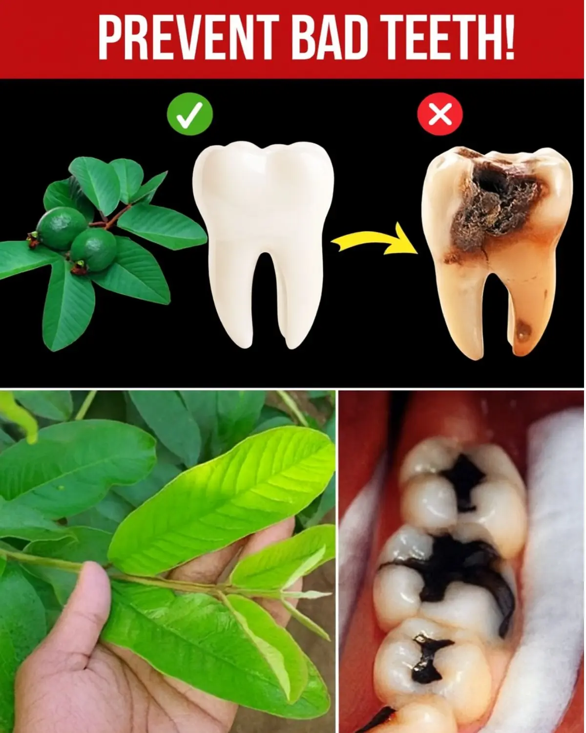 Top 3 Simple Ways Guava Leaves Can Help Ease Tooth Decay Discomfort